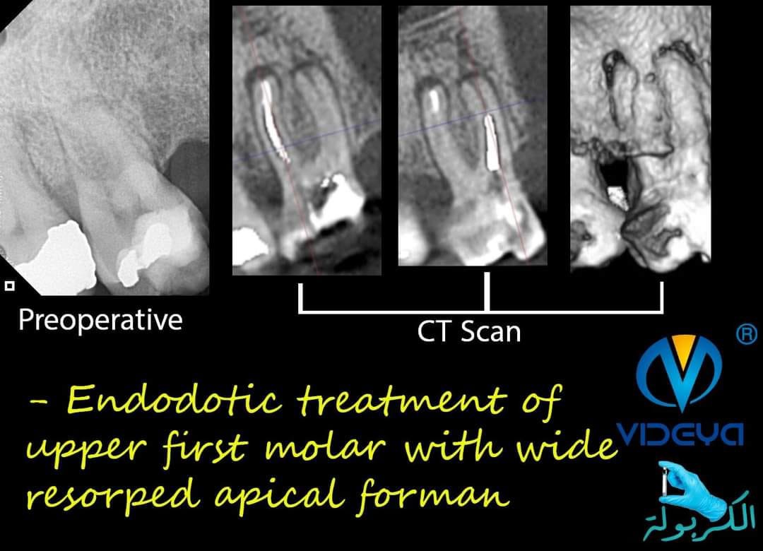 A new case from Egypt Dr ahmed abo elkhier_Clinical Case_Academy ...